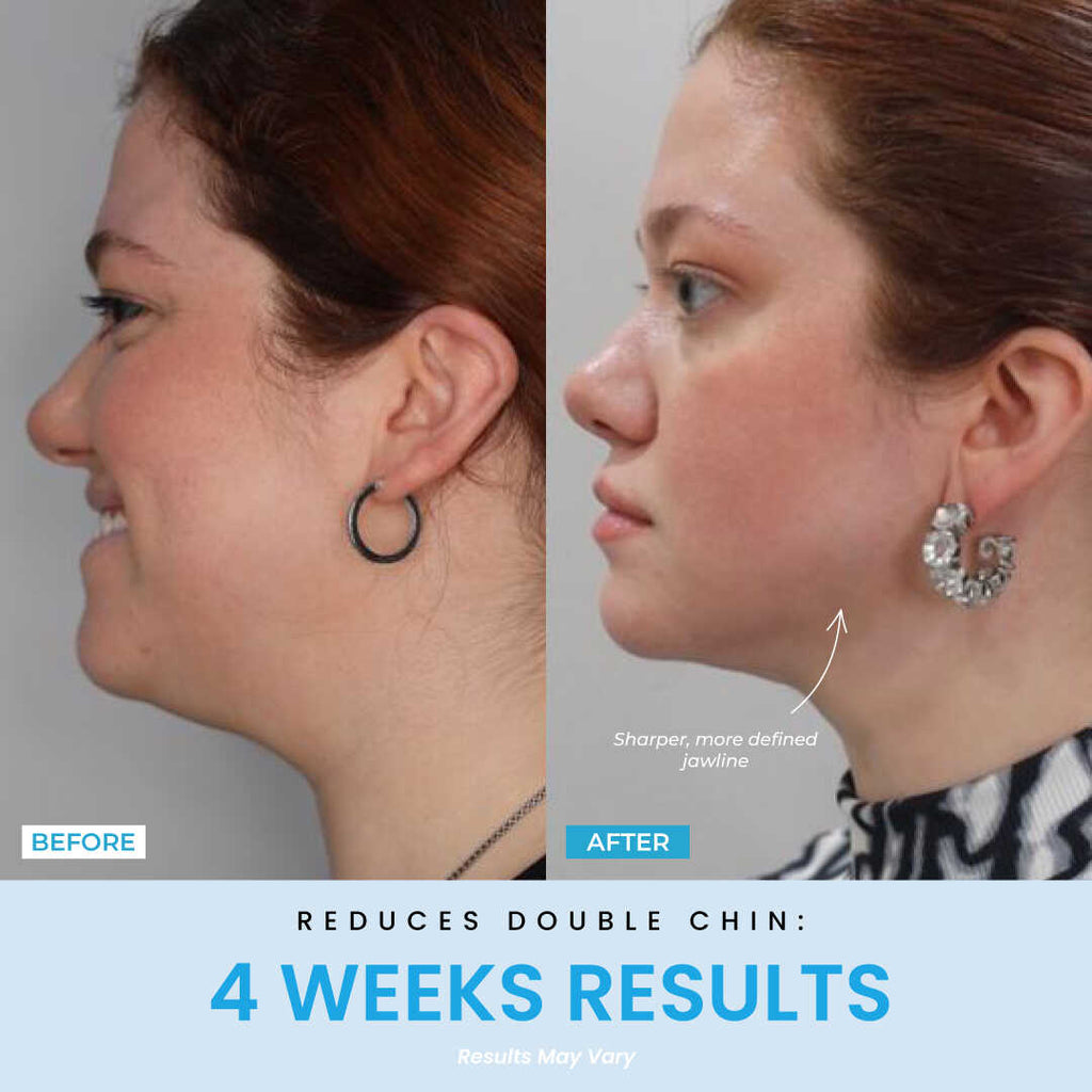 Liftlab Face Sculpting Tool - Red Light Neck & Face Lift Device